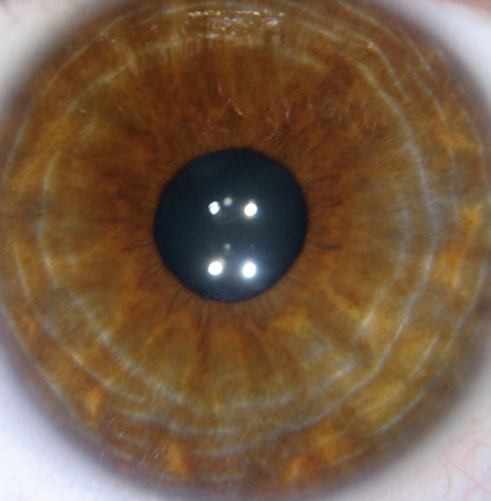 Iridology For Pets: A Window To Your Pets's Health