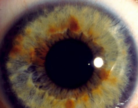 Iridology For Pets: A Window To Your Pets's Health